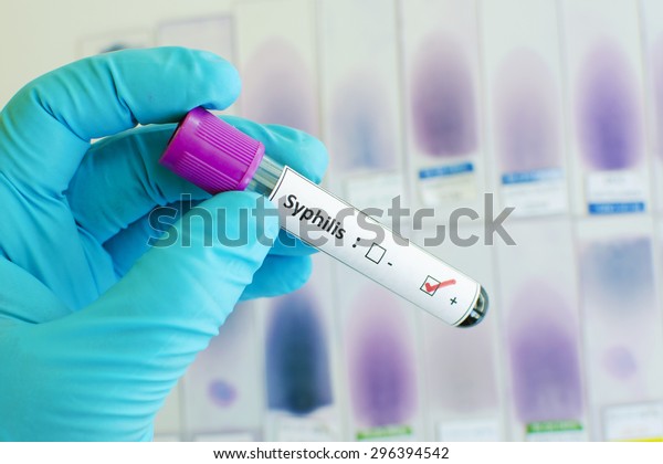 Syphilis Positive Stock Photo 296394542 | Shutterstock