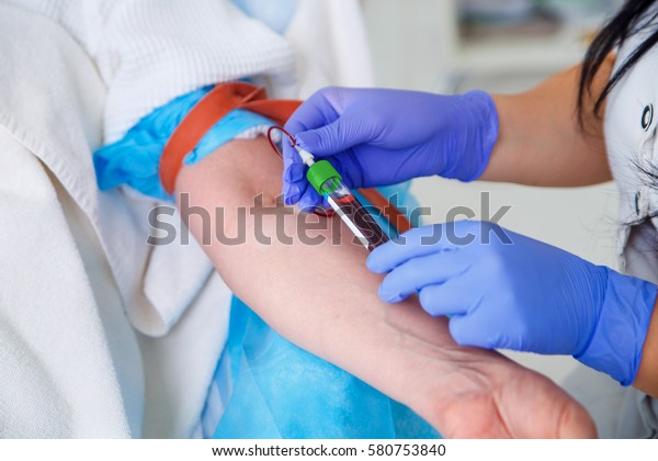 Taking Blood Sample Stock Photo 580753840 | Shutterstock