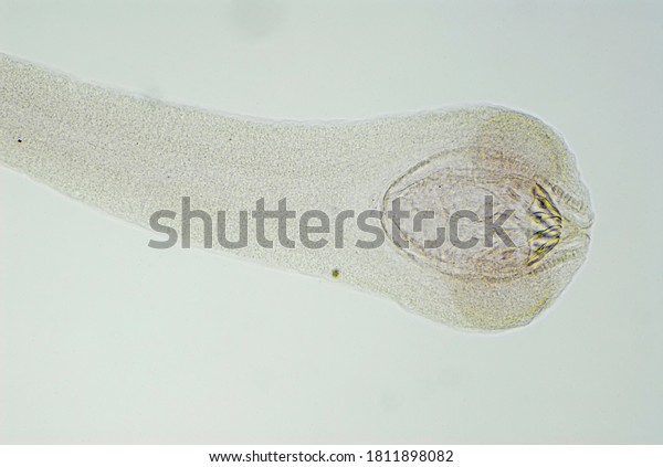 Tapeworm Scolex Under Microscope Stock Photo 1811898082 | Shutterstock