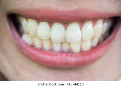 Teeth Stock Photo 413744110 | Shutterstock