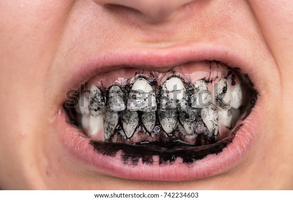 Teeth Black Woman Teeth Macro Toothpaste Stock Photo (Edit Now) 742234603