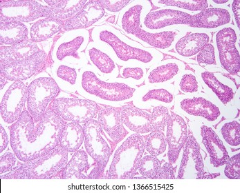 Testis Images, Stock Photos & Vectors | Shutterstock