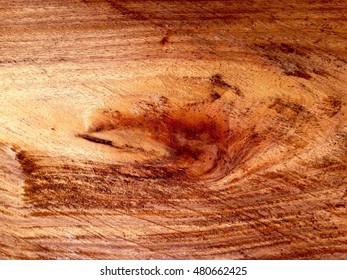 Bacterial Skin Infection Pyoderma Lichen On Stock Photo (Edit Now ...