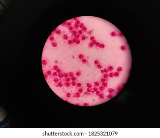 Gram Stain Showing Blue Cells Gram Stock Photo (Edit Now) 507216889