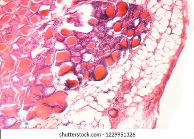Thyroid Gland Under Microscope Stock Photo 1229951326 | Shutterstock