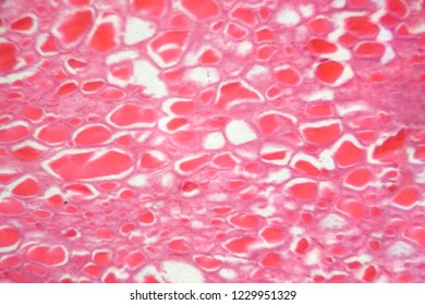 Thyroid Gland Under Microscope Stock Photo (Edit Now) 1229951329