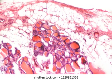 Thyroid Gland Under Microscope Foto de stock 1229951326 | Shutterstock