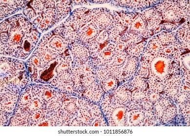 Thyroid Tissue Under Microscope 200x Stock Photo (Edit Now) 1011856876