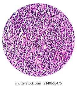 Tissue Right Axillary Lymph Node Histology Stock Photo 2140663475 ...