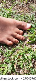 116 Missing Toe Images, Stock Photos & Vectors | Shutterstock