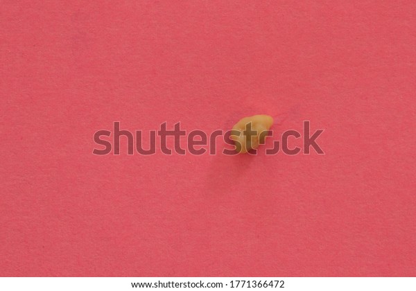 Tonsil Stone Tonsillolith On Piece Paper Stock Photo 1771366472 ...