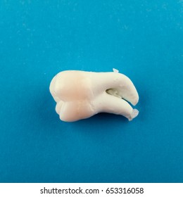 Top View Single Decayed Wisdom Tooth Stock Photo (Edit Now) 653316058