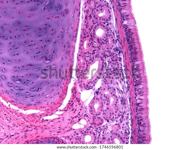 Trachea Light Microscope Micrograph Showing Right Stock Photo ...