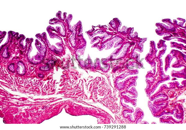 Transitional Epithelium Tissue Urinary Bladder Under Stock Photo ...