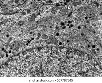 Transmission Electron Microscope Tem Micrograph Showing Stock Photo ...