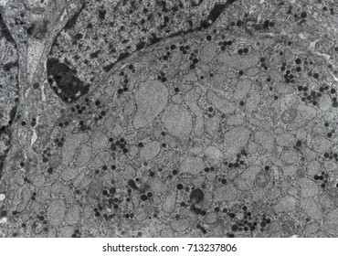 Transmission Electron Microscope Tem Micrograph Gonadotropic Stock ...