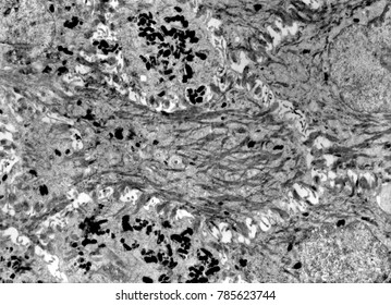 Transmission Electron Microscope Tem Micrograph Showing Stock Photo ...
