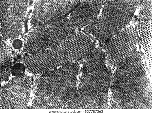 Transmission Electron Microscope Tem Micrograph Showing Stock Photo ...