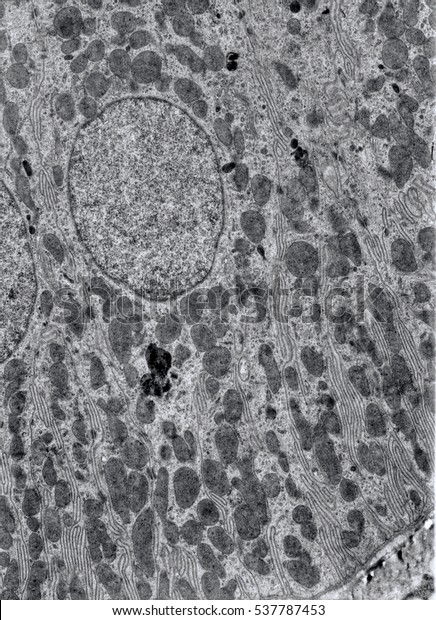 Transmission Electron Microscope Tem Micrograph Showing Stock Photo ...