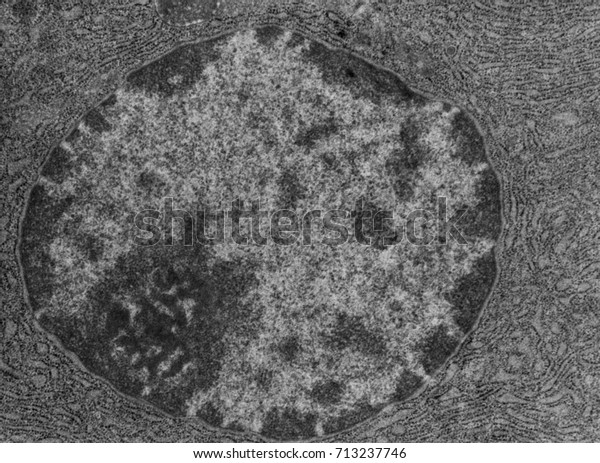 Transmission electron microscope (TEM) micrograph showing the nucleus ...
