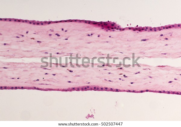 Twin Pregnancy Microscopic Image Dividing Membranes Stock Photo (Edit ... Twin Pregnancy Microscopic Image Dividing Membranes Stock Photo (Edit ...