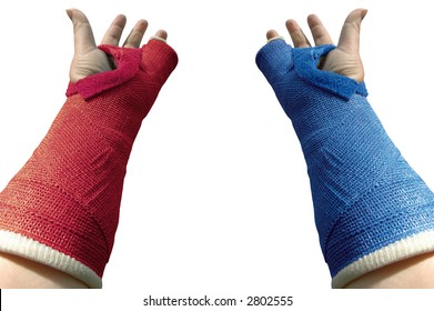 1,152 Two broken arms Images, Stock Photos & Vectors | Shutterstock