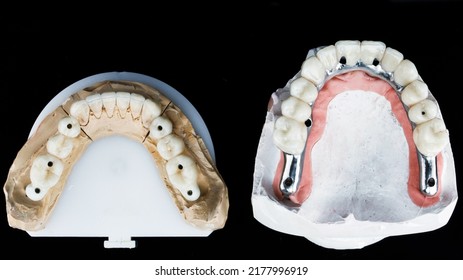 Two Dental Models Prosthesis Upper Jaw Stock Photo 2177996919 ...
