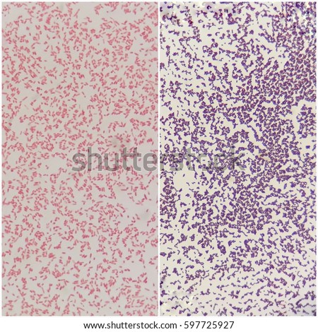 Two Pattern Smear Gram Negative Bacteria Stock Photo (Edit Now ...