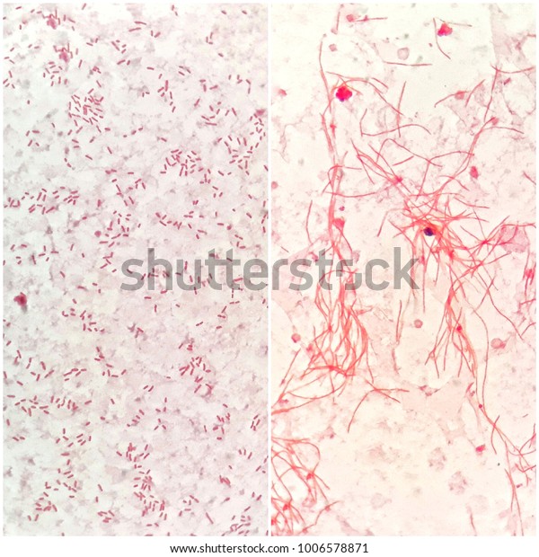 Two Pattern Smears Gram Negative Bacilli Stock Photo (Edit Now) 1006578871