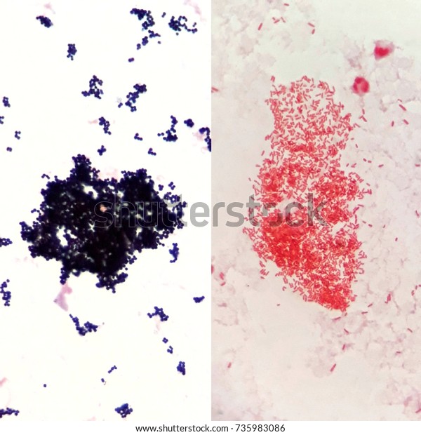 Two Pattern Smears Human Blood Culture Stock Photo (Edit Now) 735983086