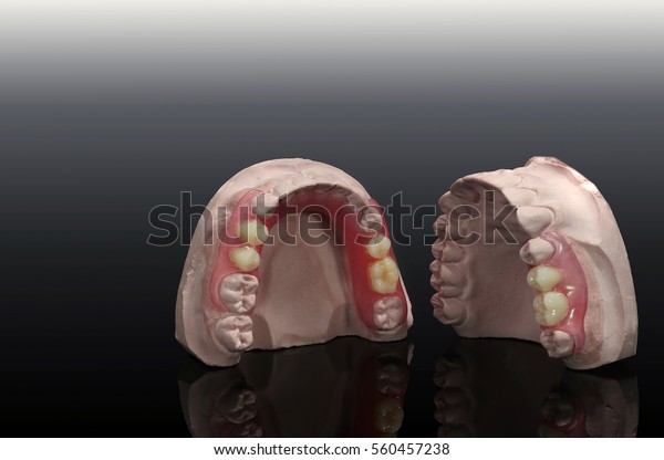 Two Temporaryplate Denture Stock Photo (Edit Now) 560457238