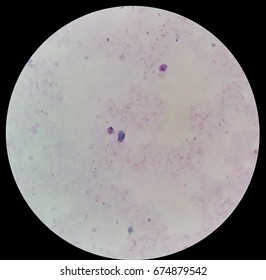 Under 100x Light Microscope Red Dye Stock Photo 597430526 | Shutterstock