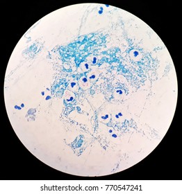 Aspergillus Terreus Under Light Microscope Stock Photo 1342788944 ...