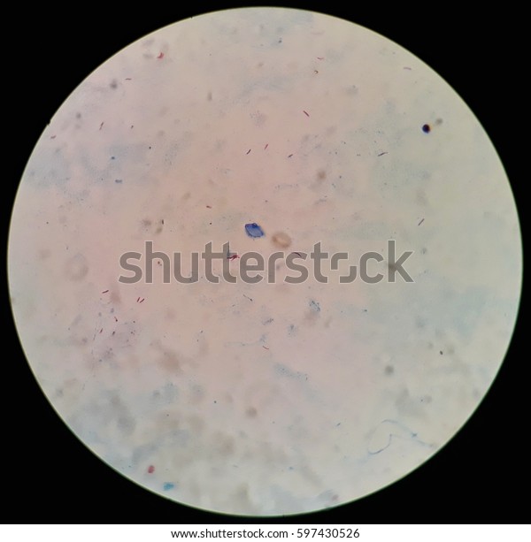 Under 100x Light Microscope Red Dye Stock Photo (Edit Now) 597430526