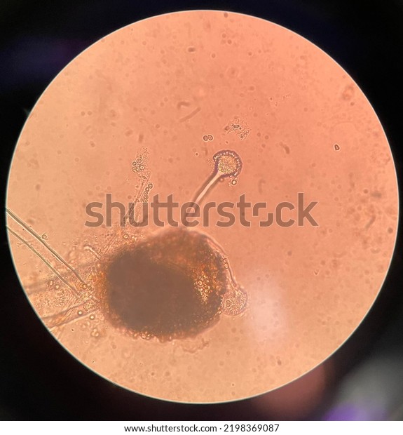 Under Microscope Showing Aspergillus Spp Stock Photo 2198369087 ...