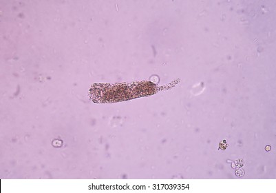Urinary Casts Cylindrical Structures Produced By Foto Stok 317039354 ...