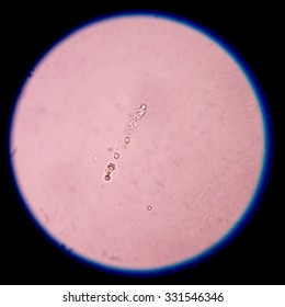 Urinary Casts Cylindrical Structures Produced By Stock Photo 331546346 ...