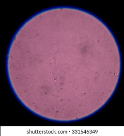 Uroerythrin Images, Stock Photos & Vectors | Shutterstock