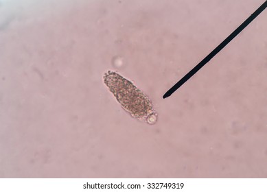 62 Urinary Cast Images, Stock Photos & Vectors | Shutterstock
