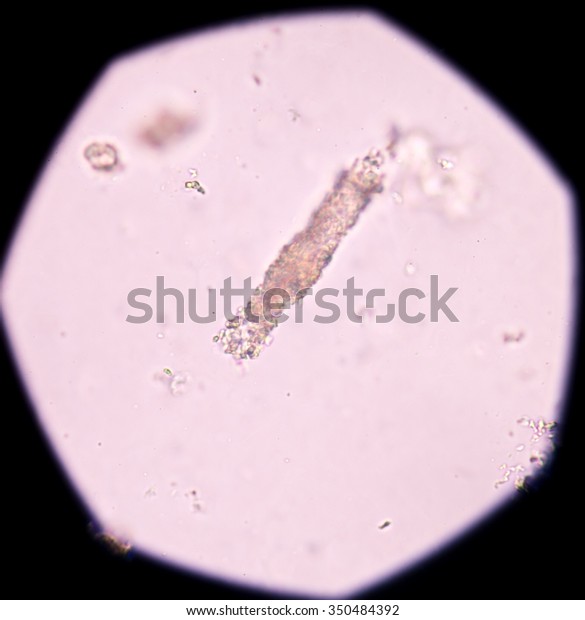 Urinary Casts Cylindrical Structures Produced By Stock Photo 350484392 ...