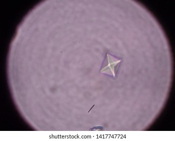 Urinary Crystal Under Microscope View Stock Photo 1417747724 | Shutterstock