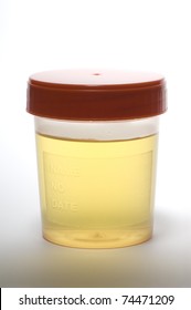 Urine Sample Stock Photo 74471209 | Shutterstock