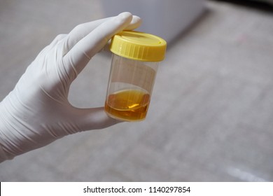 Urine Sample Urine Analysis Stock Photo 1140297854 | Shutterstock