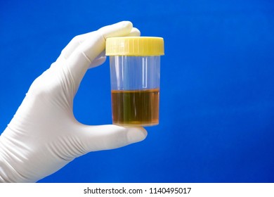 Urine Sample Urine Analysis Stock Photo 1140495017 | Shutterstock
