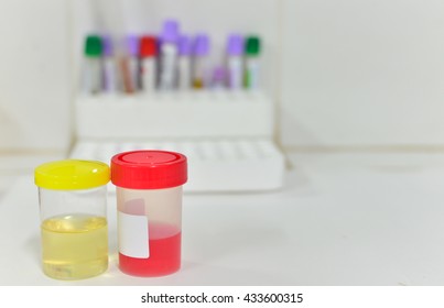 Urine Sample Bottle Red Urine Normal Stock Photo 433600315 | Shutterstock