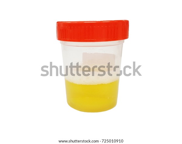 Urine Sample Container Isolated On White Stock Photo (Edit Now) 725010910