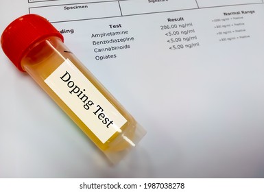 Urine Sample Doping Test Doping Test Stock Photo 1987038278 | Shutterstock
