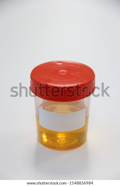 Urine Sample Laboratory Analysis Stock Photo 1548836984 | Shutterstock