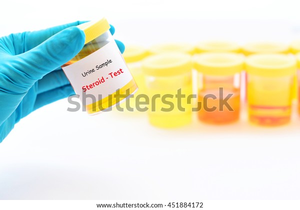 Urine Sample Steroid Test Stock Photo (Edit Now) 451884172