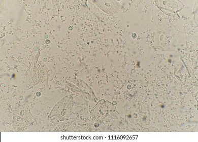 Urine Sample Under Microscope Stock Photo 1116092657 | Shutterstock